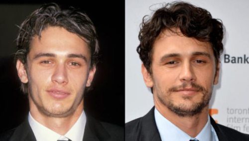 Famous Faces Before They Were Stars (46 Pics)