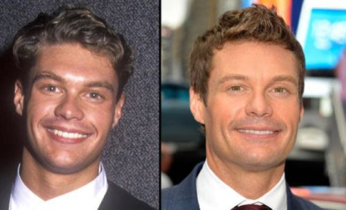 Famous Faces Before They Were Stars (46 Pics)
